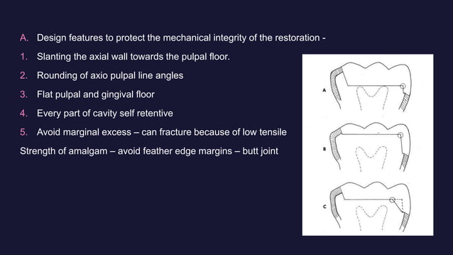 Class 2 cavity amalgam | PPT