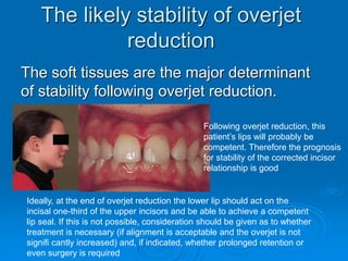 Class II Divison 1 Orthodontics Dentistry by Cezar E. | PDF