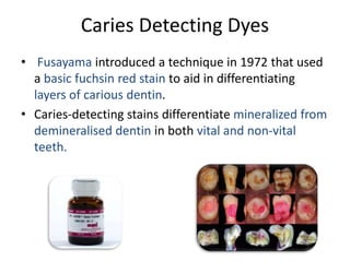 Class 2 Caries & Diagnostic Aids in Endodontics | PPTX