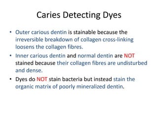 Class 2 Caries & Diagnostic Aids in Endodontics | PPTX