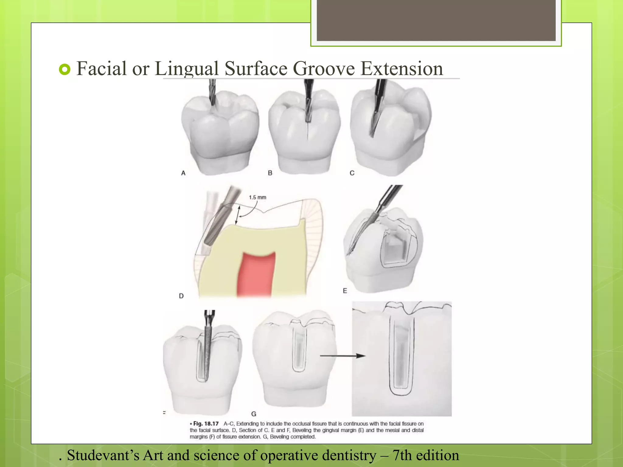 class 2 inlay 1.pptx