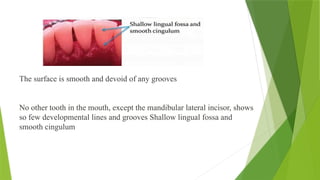 class 2 permenant mandibular incisors. | PPTX