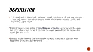 Class 3 malocclusion class III malocclusion profit | PPTX