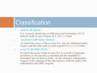 Class 3 malocclusion | PPTX