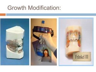 Class 3 malocclusion | PPTX