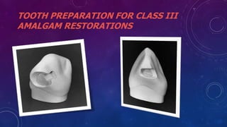 Class 3 tooth preparation | PPTX