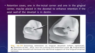 Class 3 tooth preparation | PPTX
