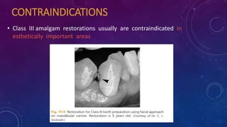 Class 3 tooth preparation | PPTX