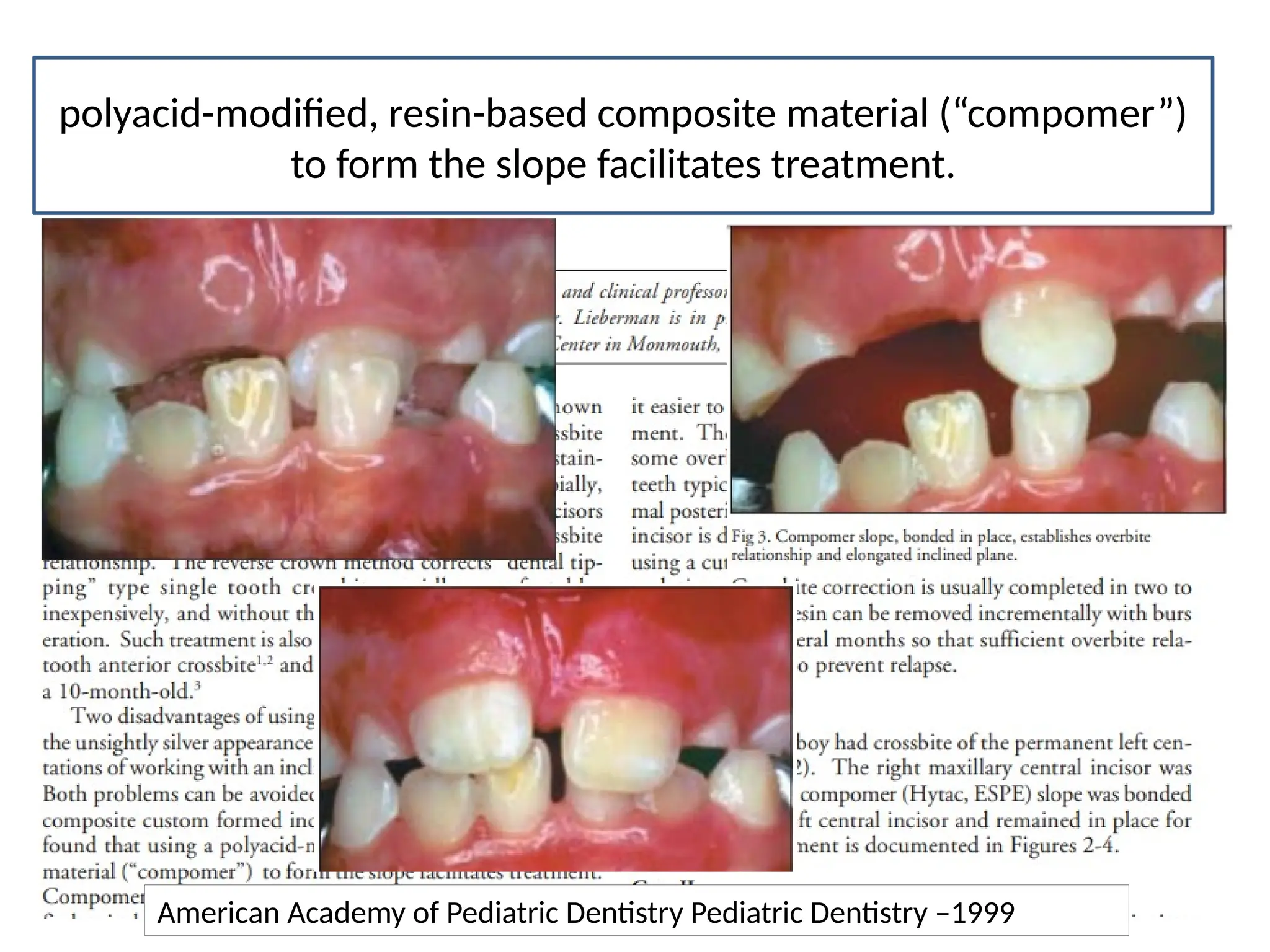 class 3 treatment.pptx GHUGVKGHVKHKVBJBIBKN | PPTX