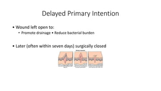 CLASS 3 WOUND HEALING.pptx | First Aid | Injuries