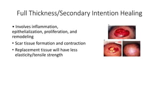 CLASS 3 WOUND HEALING.pptx