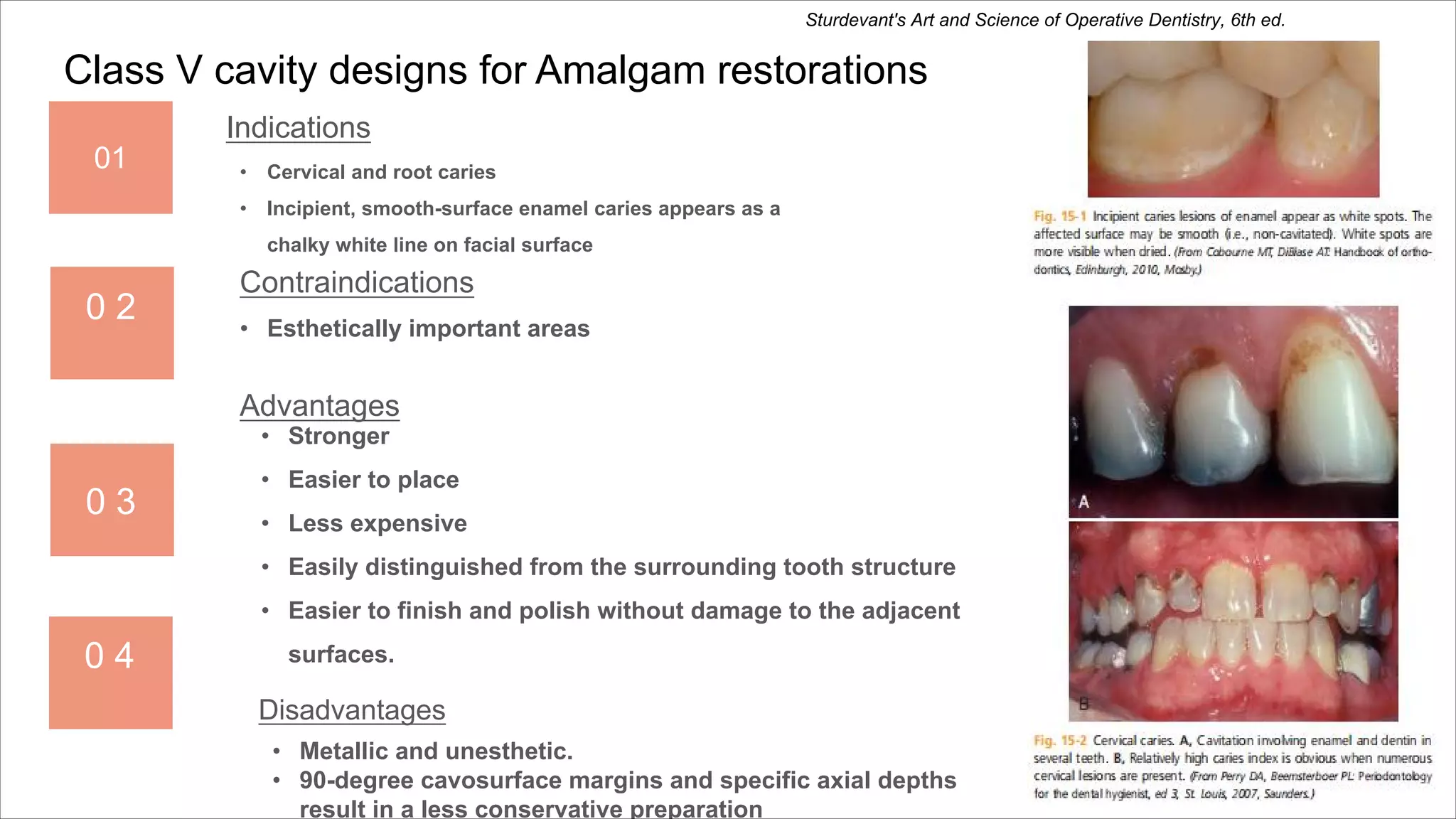 Class 5 Cavity Designs Pdf Dental Health Diseases And Conditions