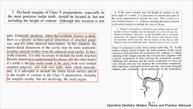 Class 5 cavity designs | PDF | Dental Health | Diseases and Conditions