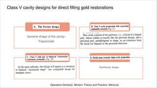 Class 5 cavity designs | PDF