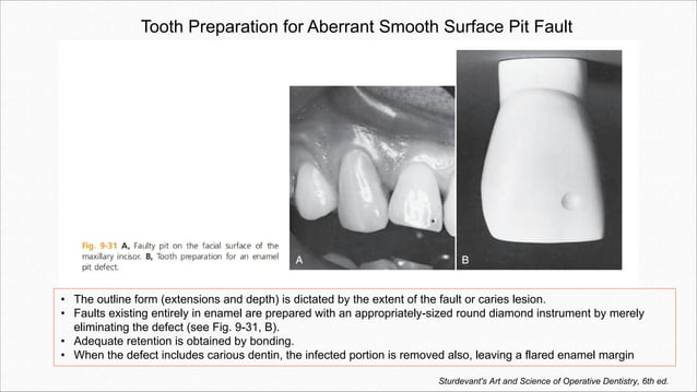 Class 5 cavity designs | PDF | Dental Health | Diseases and Conditions