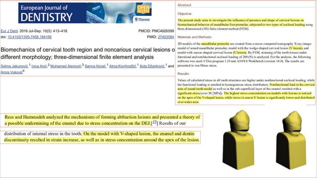 Class 5 cavity designs | PDF | Dental Health | Diseases and Conditions