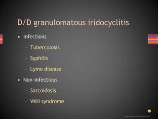 Panuveitis | PPTX