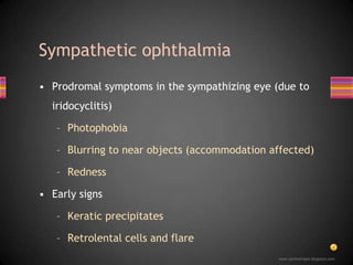 Panuveitis | PPTX