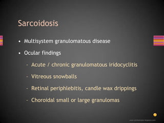 Panuveitis