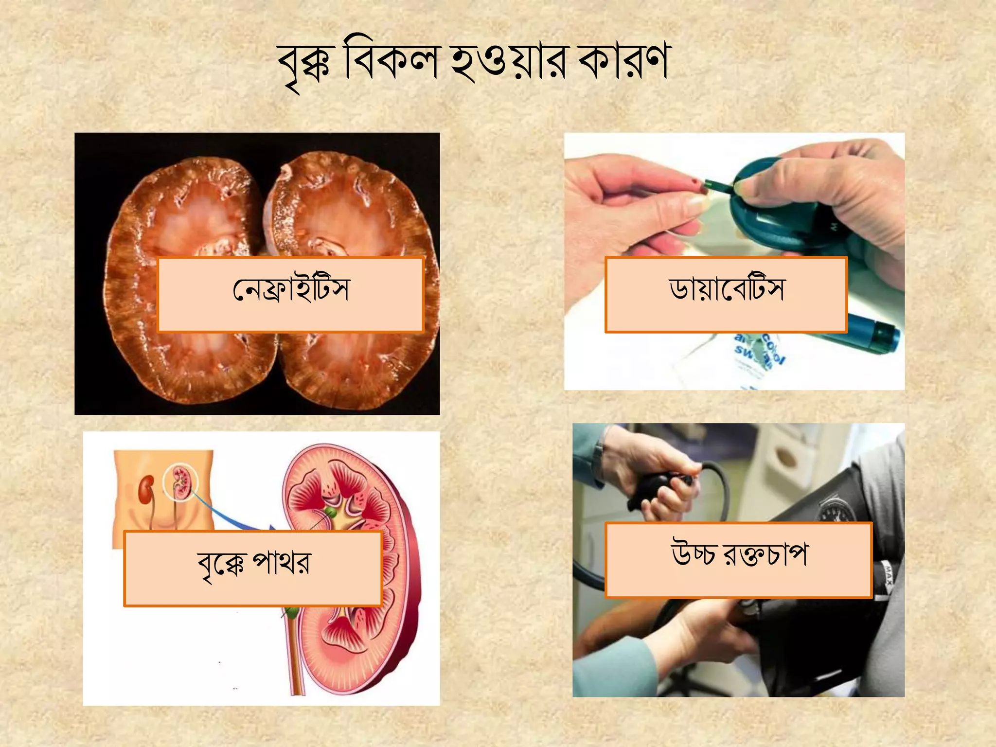 Class 9 & 10 biology lesson 8 class 4 dialysis | PPTX