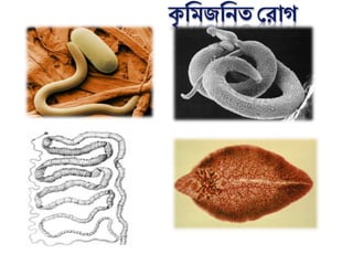 Class 9 & 10 class lesson- 13 round worm diseasis | PPT