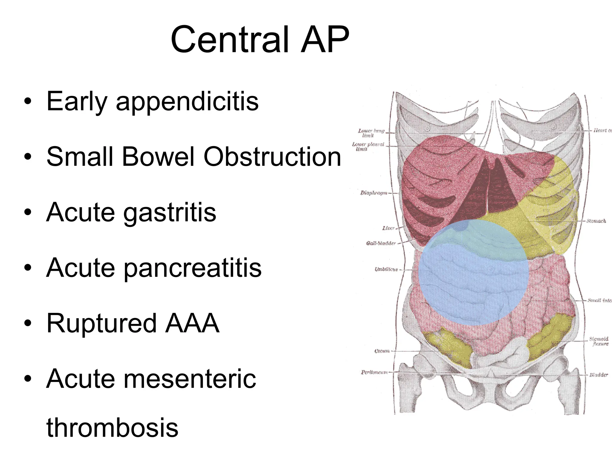 class acute abdomen other causes.pdf PPT.pdf