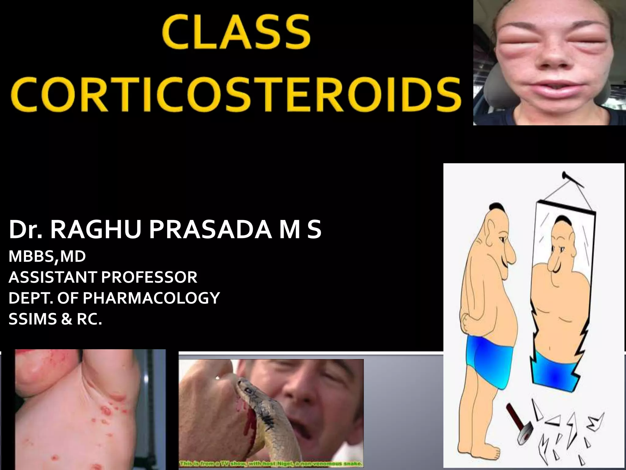 Class corticosteroids new | PPTX