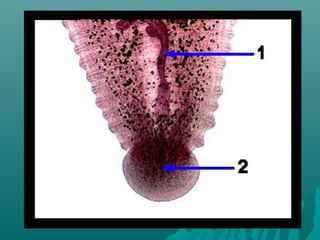 Hirudinea Cross Section
