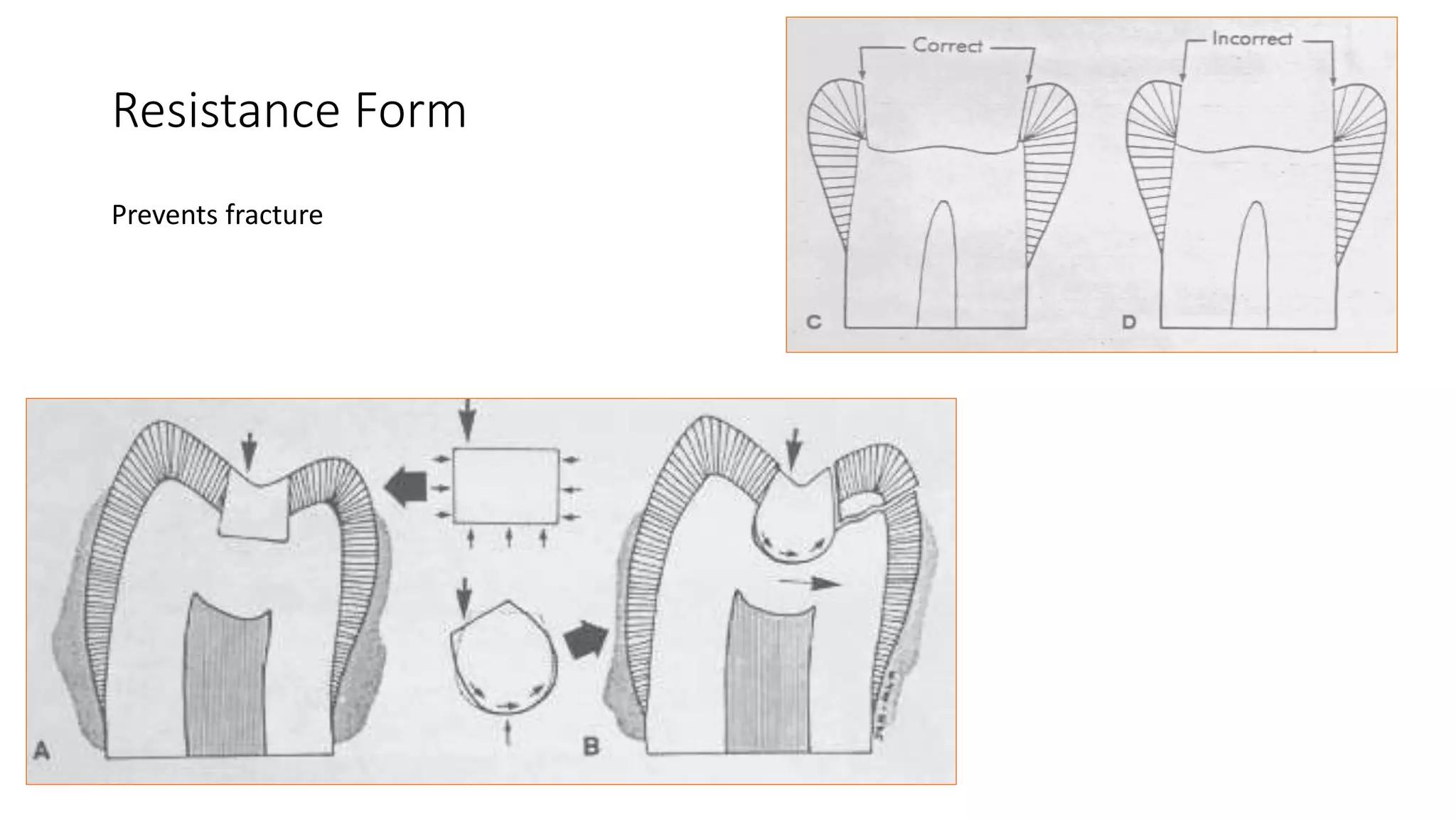 Class i amalgam preps | PPTX