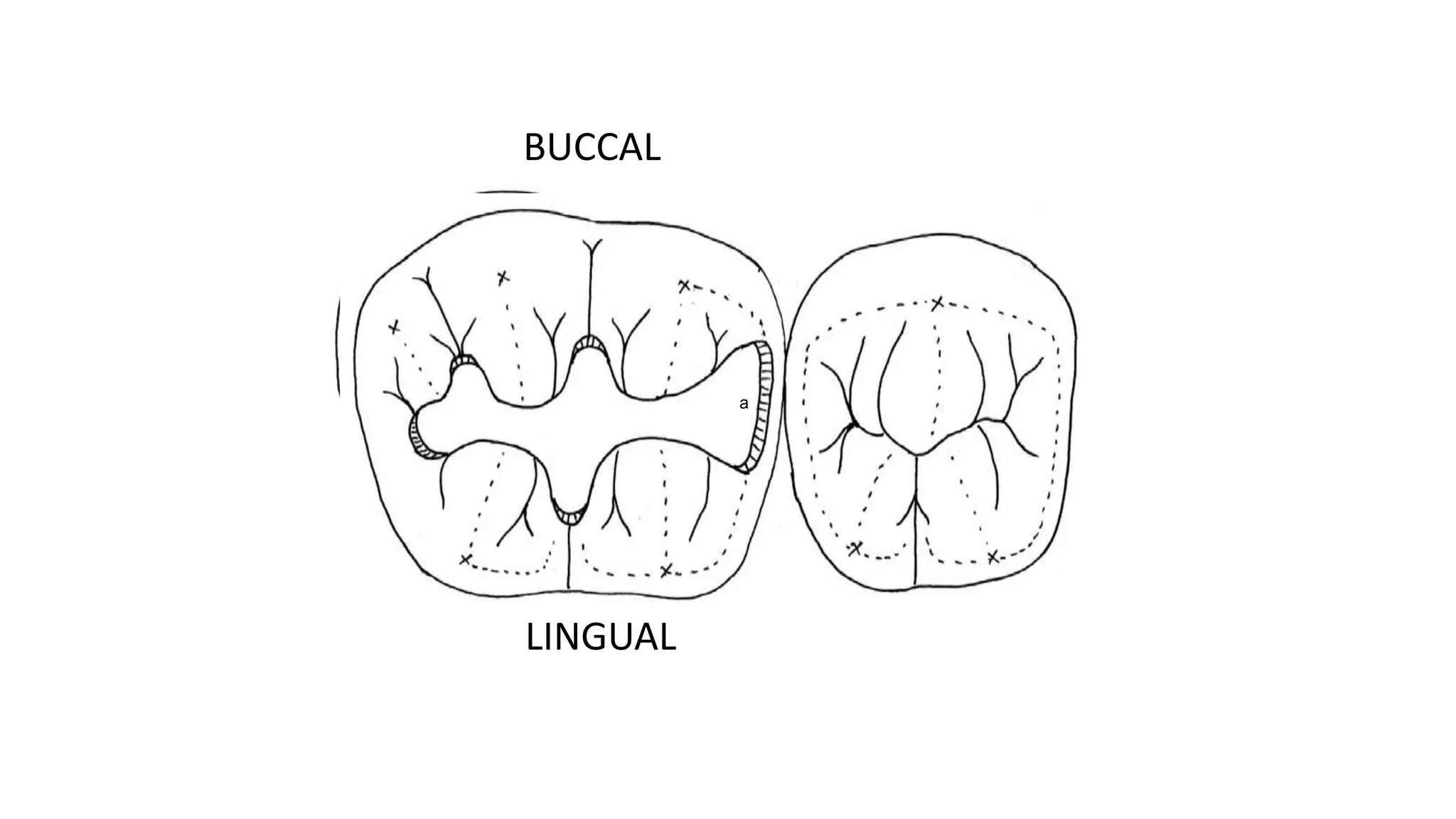 Class i amalgam preps | PPTX