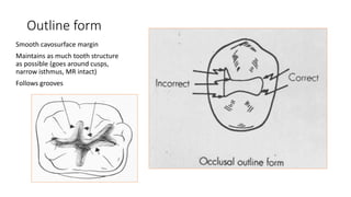Class i amalgam preps | PPTX