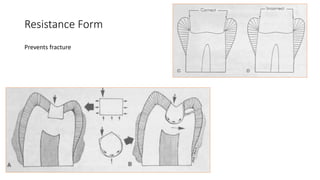 Class i amalgam preps | PPTX