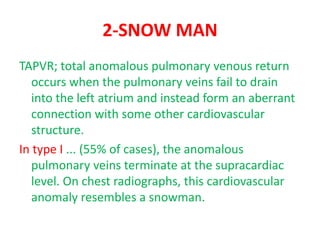 Classical cong.h disease 5th power point presentation (3) | PPTX