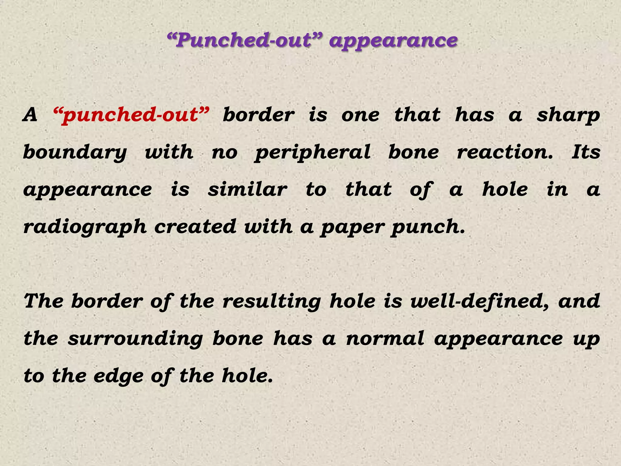 Classical signs in oral and maxillofacial radiology.pptx