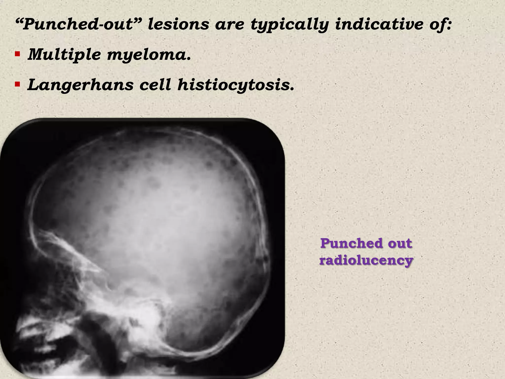 Classical signs in oral and maxillofacial radiology.pptx