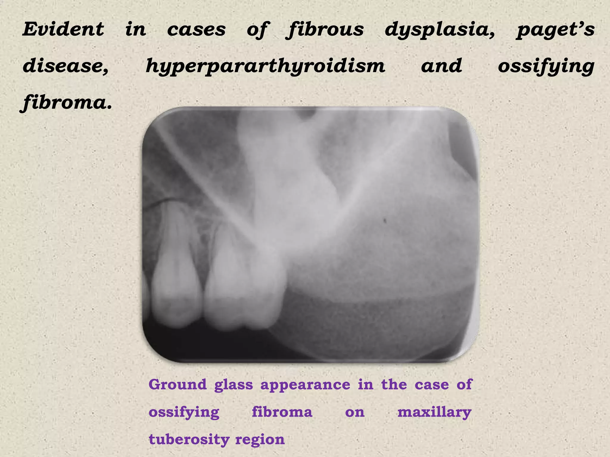 Classical signs in oral and maxillofacial radiology.pptx