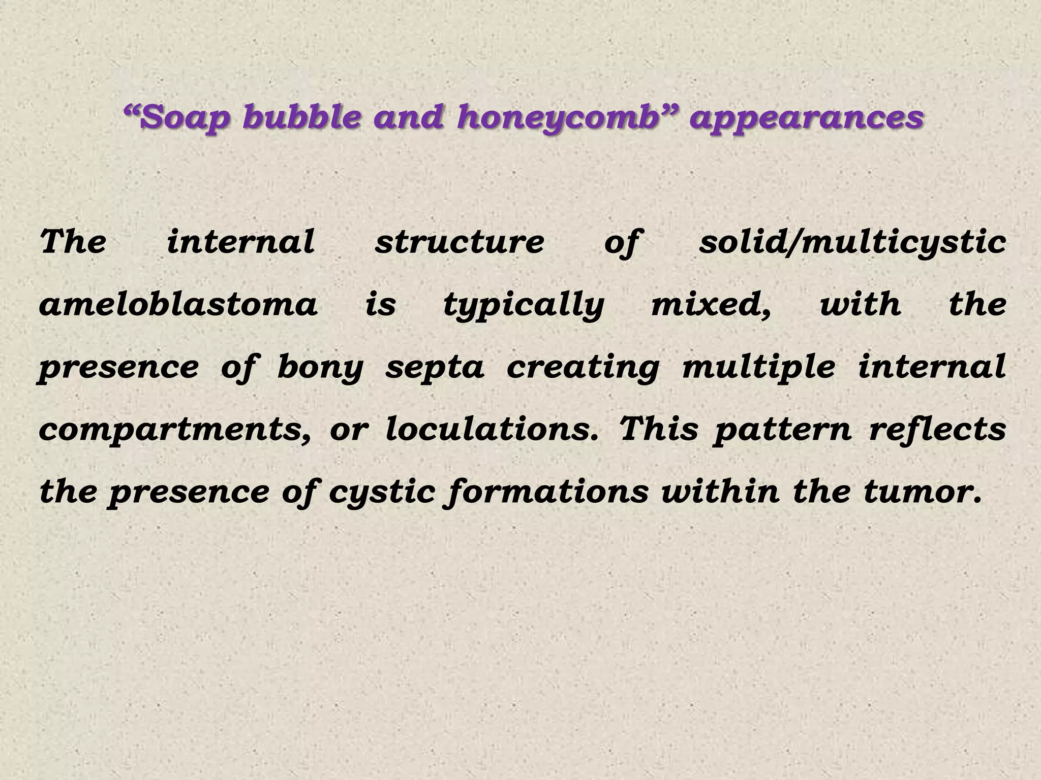 Classical signs in oral and maxillofacial radiology.pptx