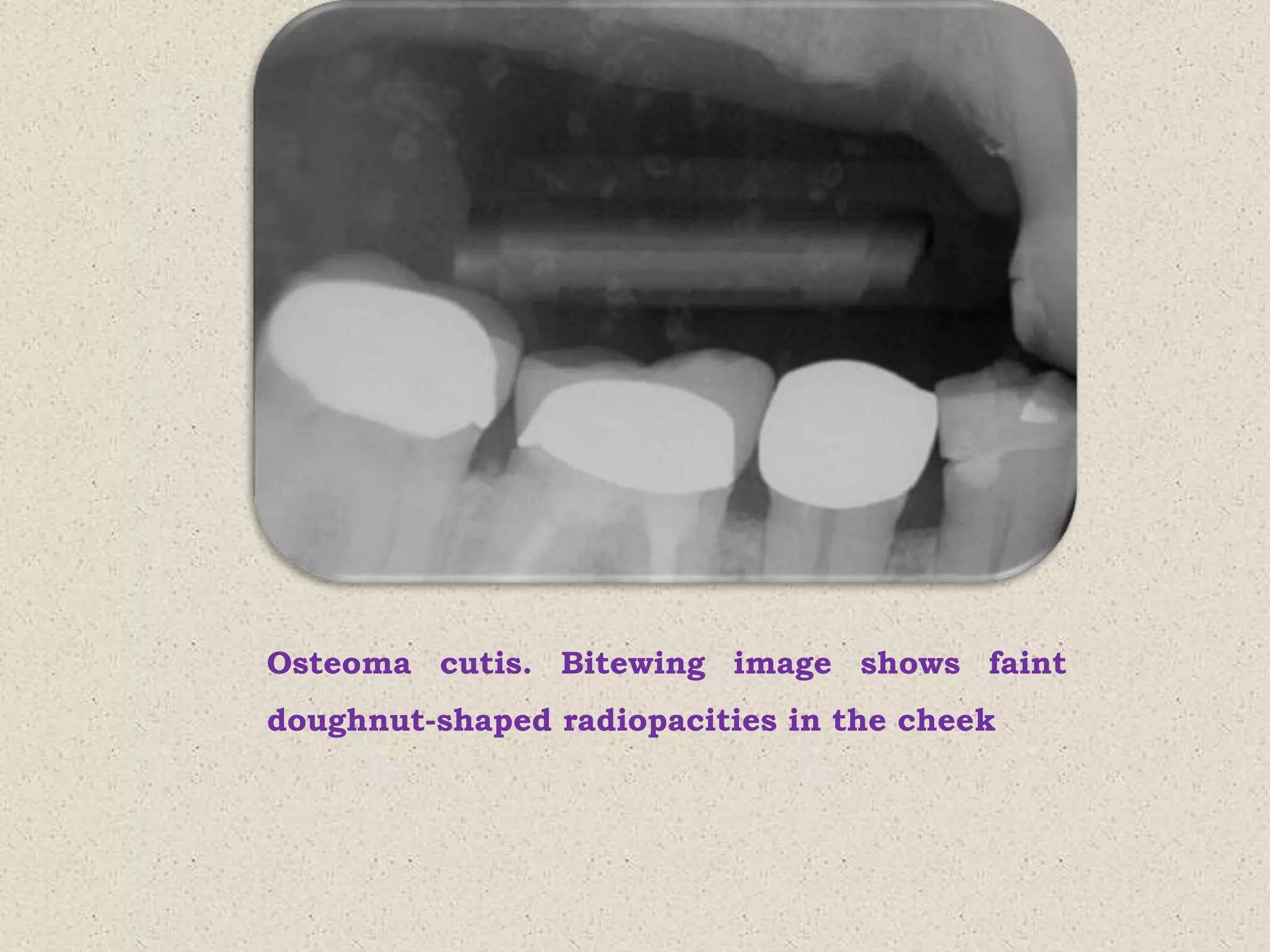 Classical signs in oral and maxillofacial radiology.pptx