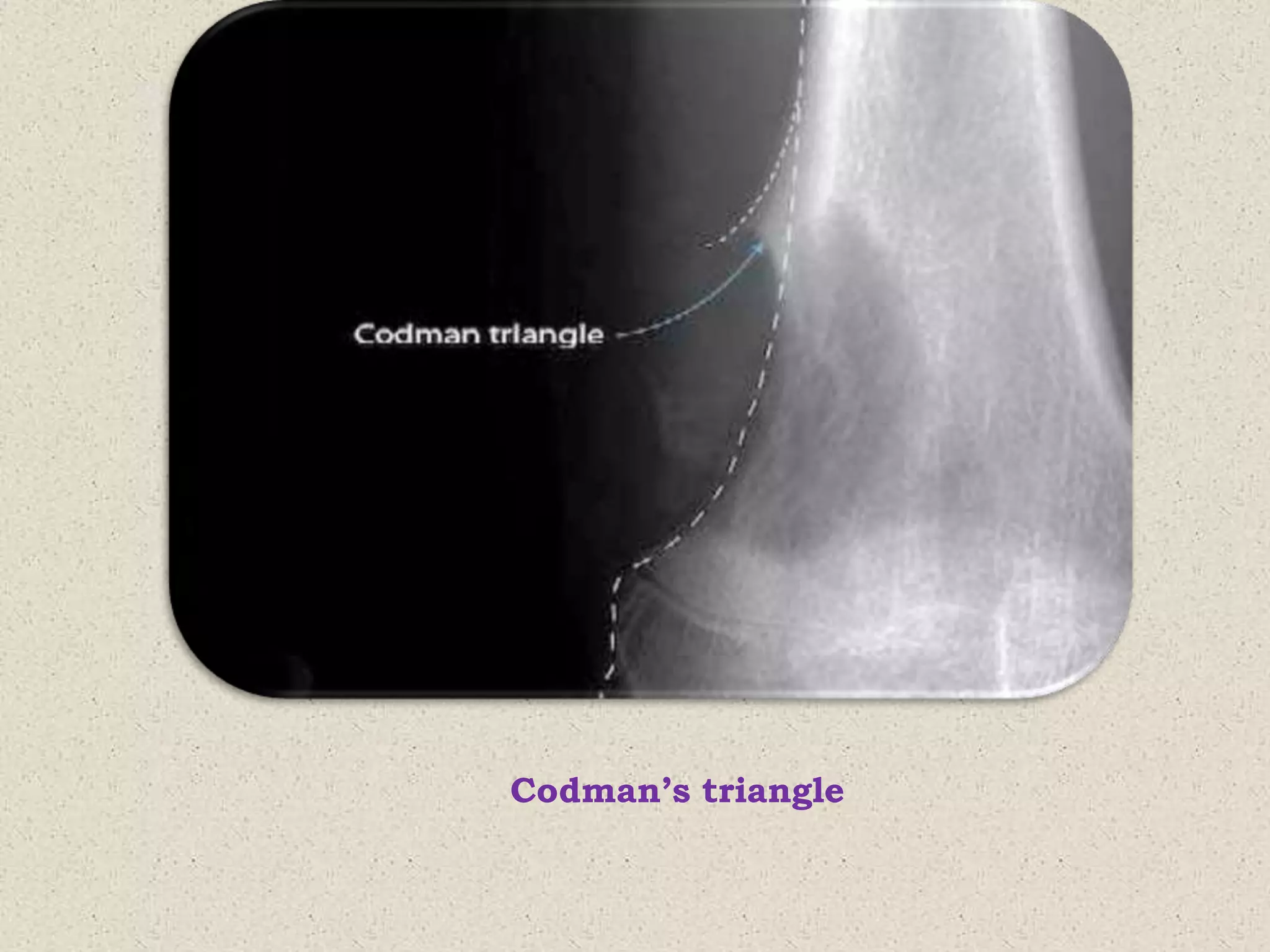 Classical signs in oral and maxillofacial radiology.pptx