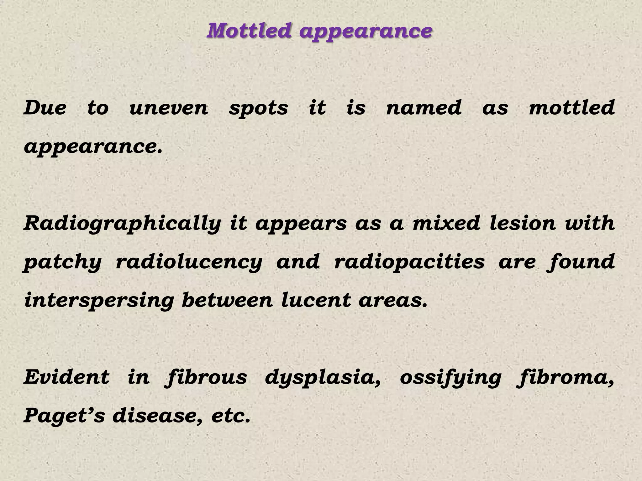 Classical signs in oral and maxillofacial radiology.pptx