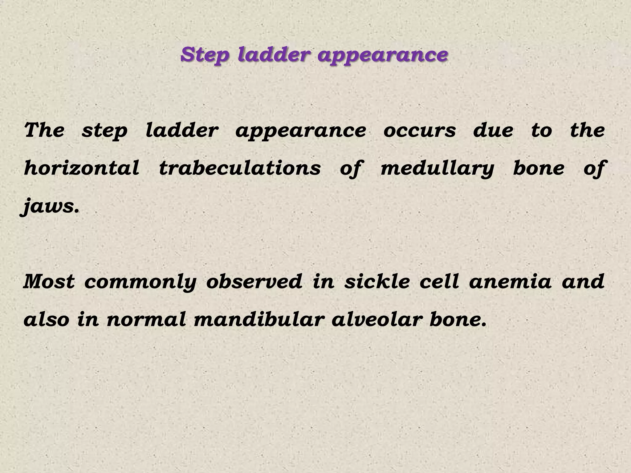 Classical signs in oral and maxillofacial radiology.pptx