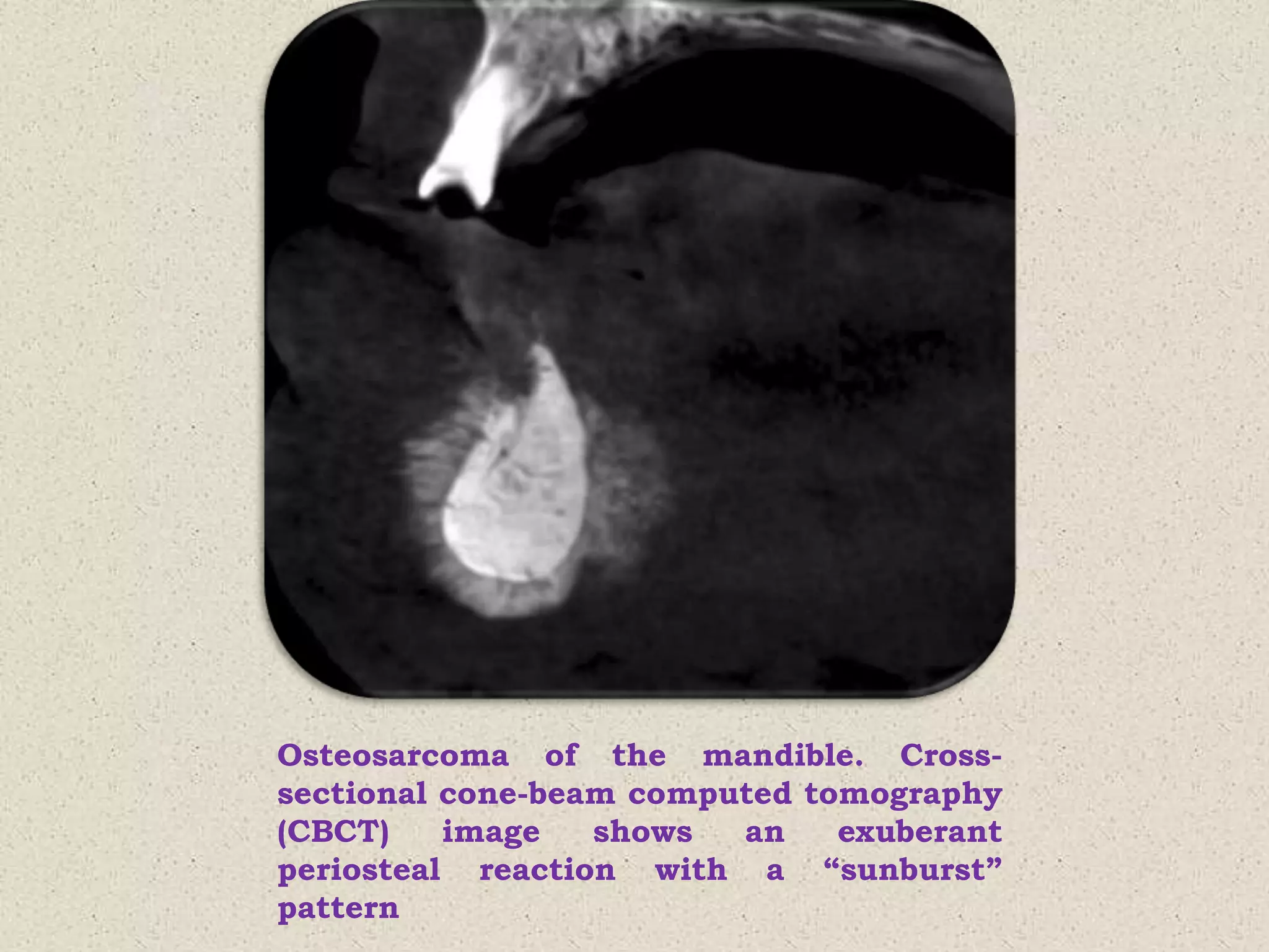 Classical signs in oral and maxillofacial radiology.pptx