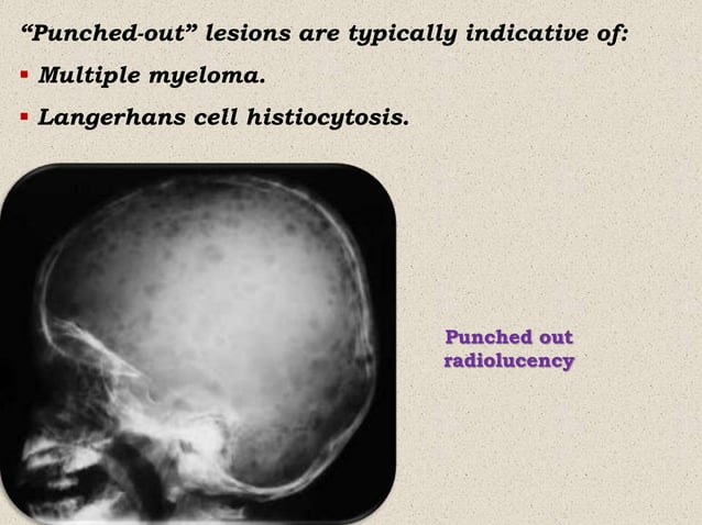 Classical signs in oral and maxillofacial radiology.pptx | Bone and ...
