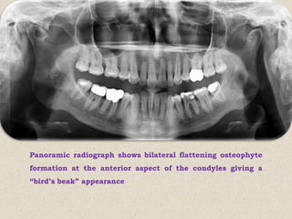 Classical signs in oral and maxillofacial radiology.pptx