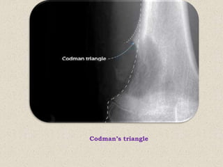 Classical signs in oral and maxillofacial radiology.pptx