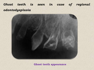 Classical signs in oral and maxillofacial radiology.pptx