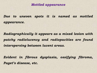 Classical signs in oral and maxillofacial radiology.pptx