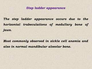 Classical signs in oral and maxillofacial radiology.pptx