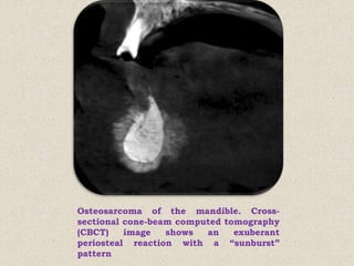Classical signs in oral and maxillofacial radiology.pptx