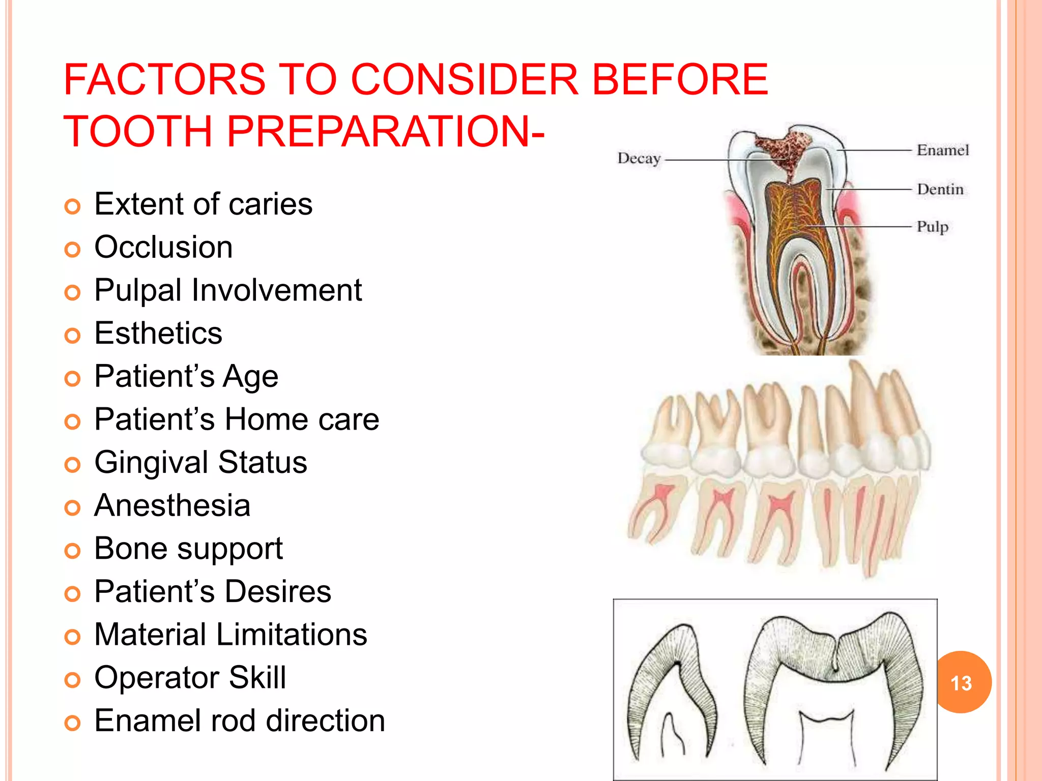 Class i cavity preparation | PPTX
